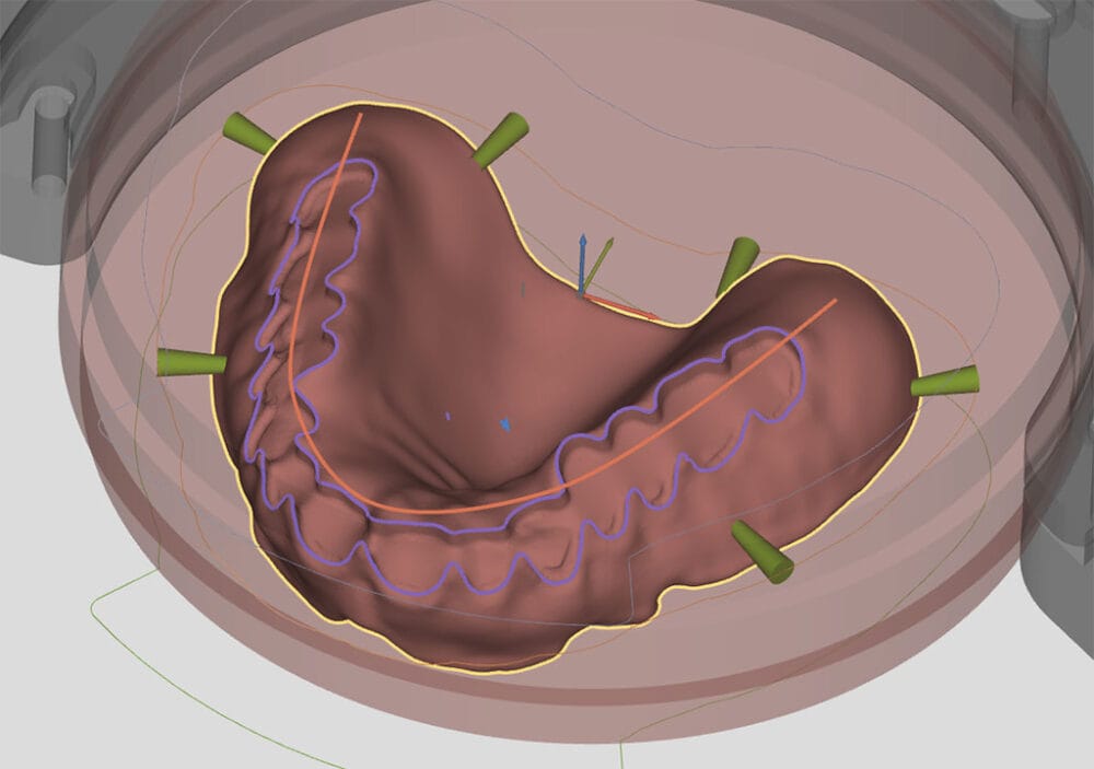 hyperDENT® Dental CAM Software | 3D Prime Technologies