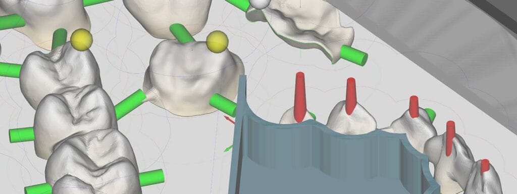 hyperDENT® Dental CAM Software | 3D Prime Technologies